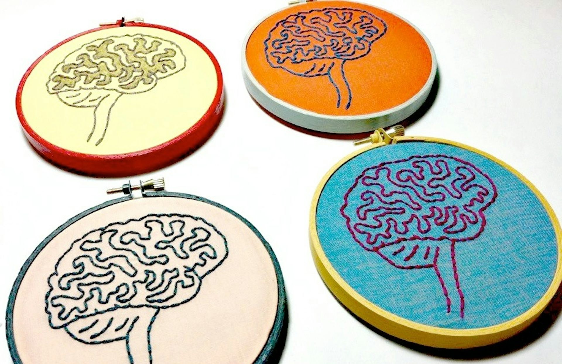 What is brain plasticity and why is it so important?